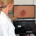 Skin Cancer Clinic Gold Coast - Skin Check Australia